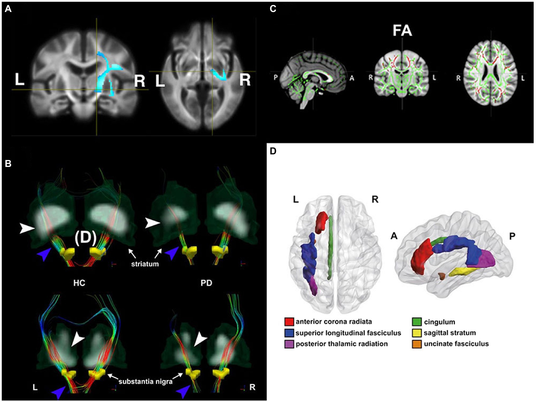 Frontiers Recent Advances In Using Diffusion Tensor Imaging To Study