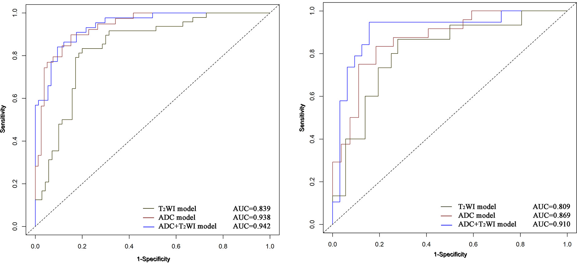 An Mri Based Radiomics Nomogram In Predicting Histologic Grade Of Non