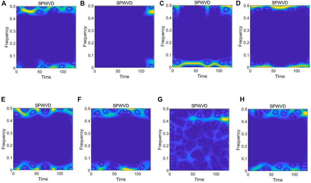 Frontiers Multimodal Attention Based Deep Learning For Automatic
