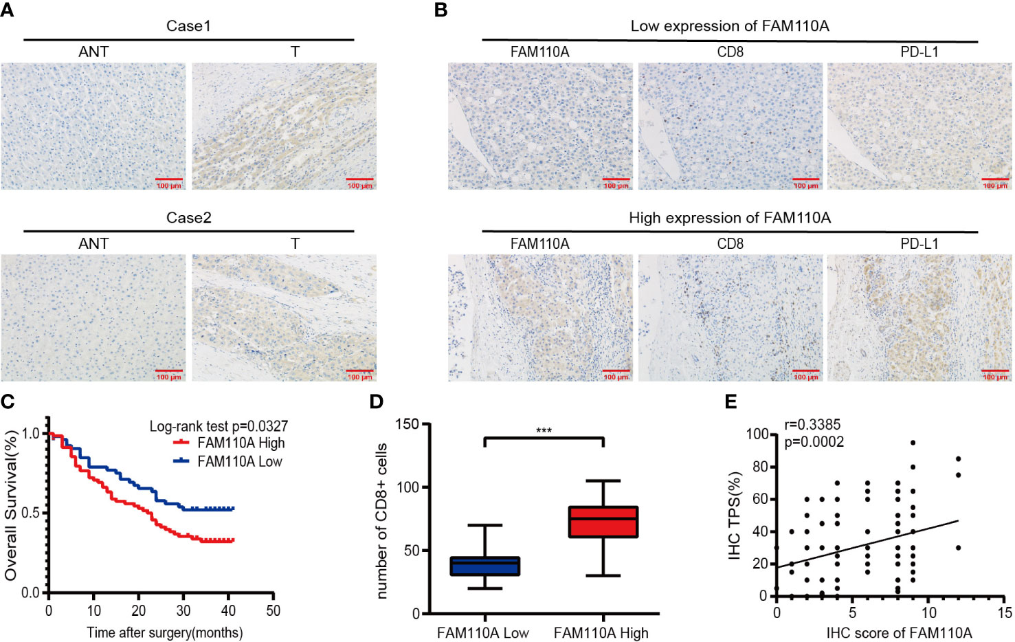 Frontiers Pan Cancer Analysis Reveals Potential Of Fam110a As A