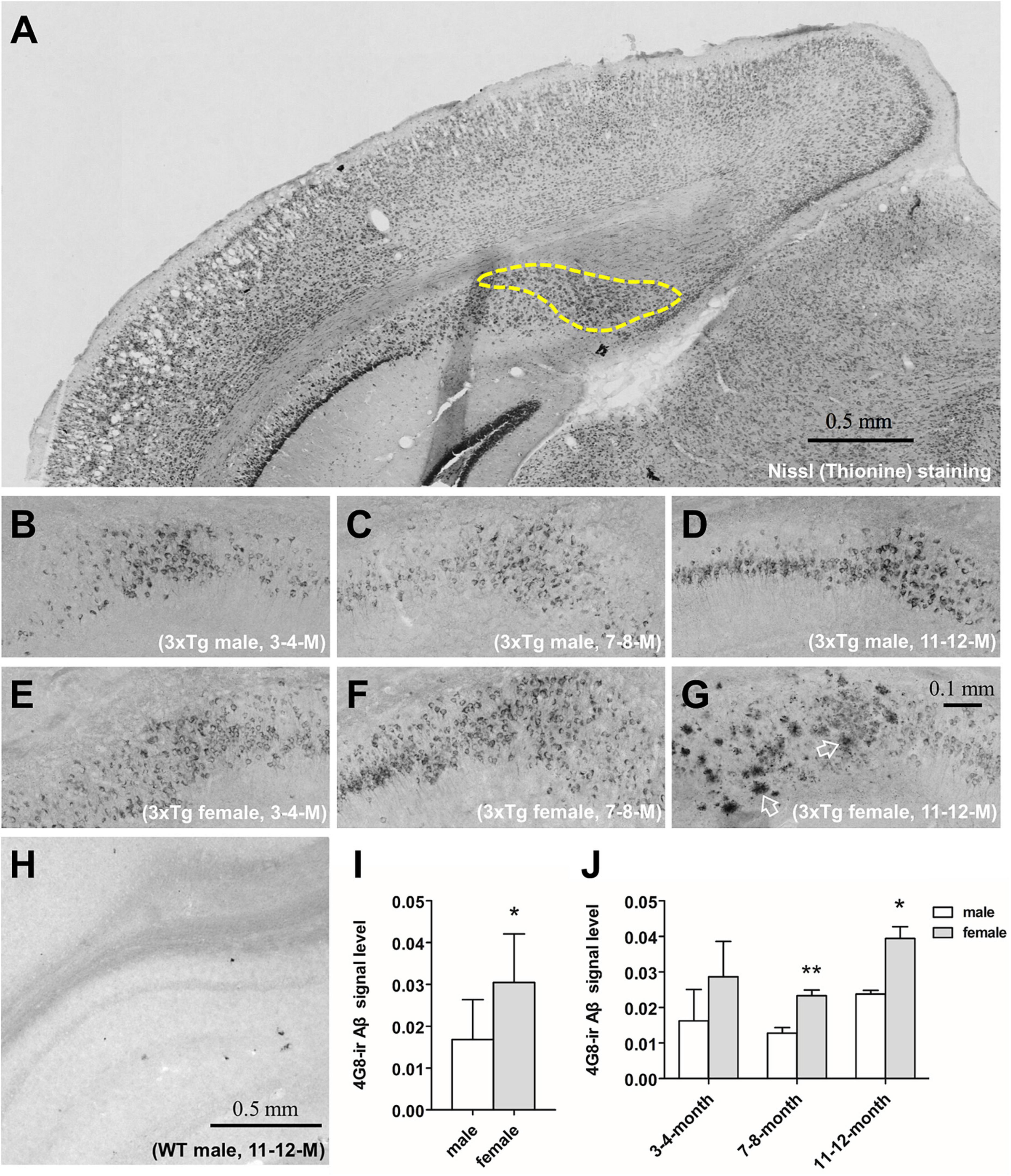 Sex Differences In Hippocampal β Amyloid Accumulation In The Triple