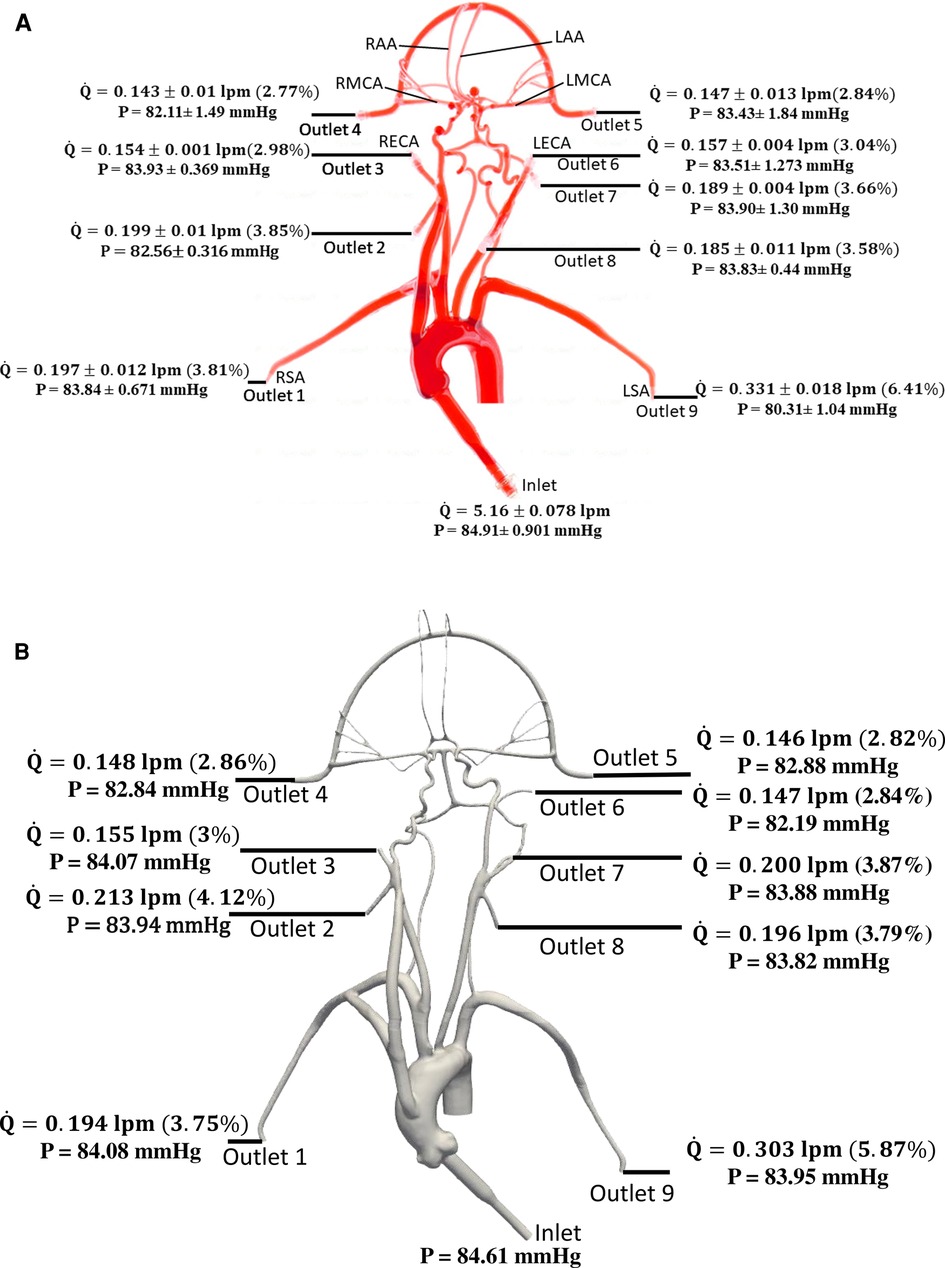 Frontiers | Modeling flow in an in vitro anatomical cerebrovascular model with experimental ...