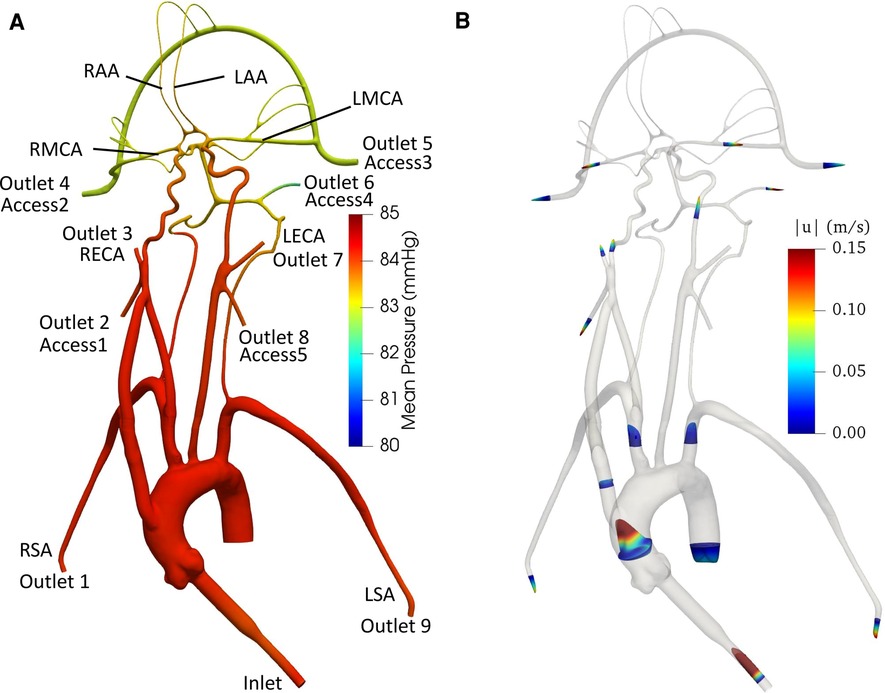 Frontiers | Modeling flow in an in vitro anatomical cerebrovascular model with experimental ...