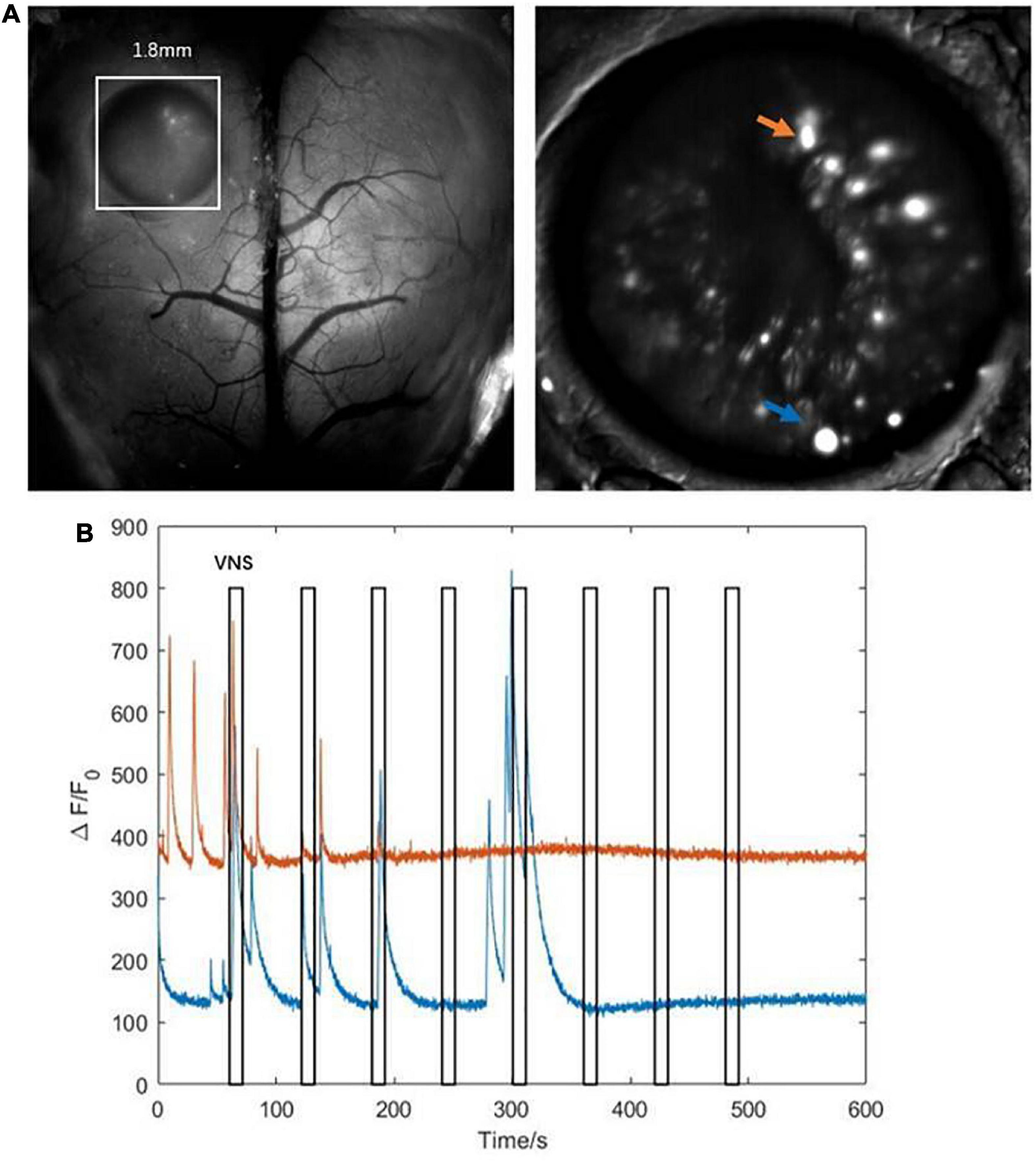 Cerebral cortex and hippocampus neural interaction during vagus nerve ... Cerebral cortex and hippocampus neural interaction during vagus nerve ...