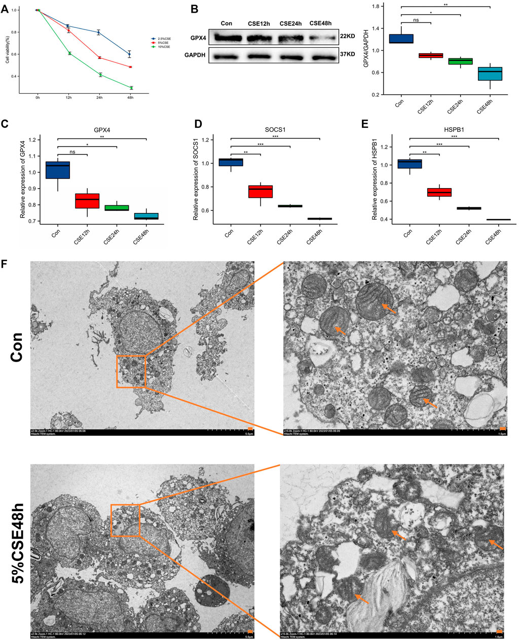 Integrating RNA-seq and scRNA-seq to explore the mechanism of ... Integrating RNA-seq and scRNA-seq to explore the mechanism of ...