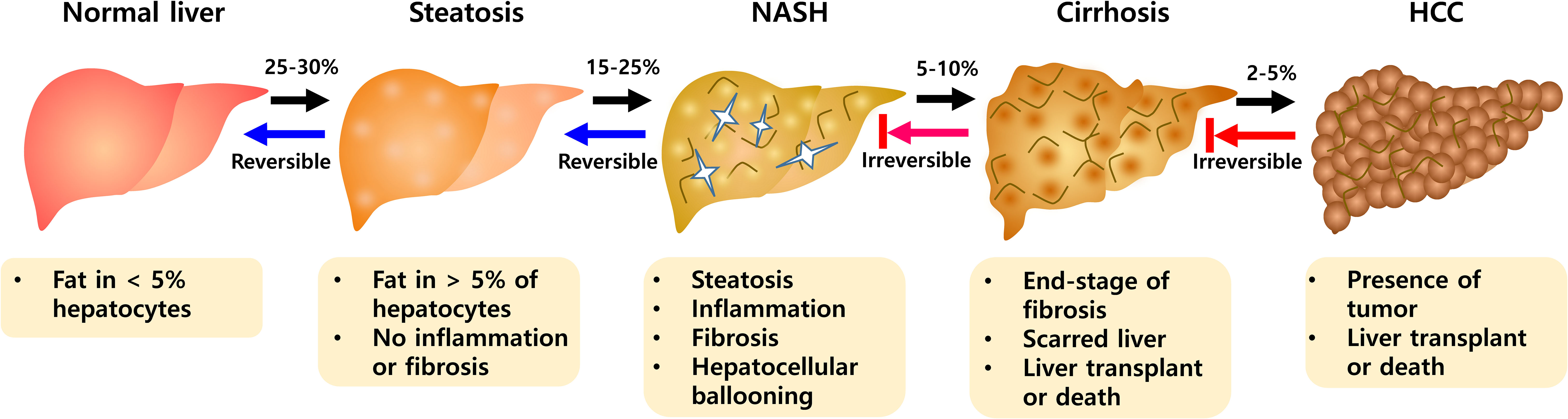 Frontiers Major Roles Of Kupffer Cells And Macrophages In Nafld