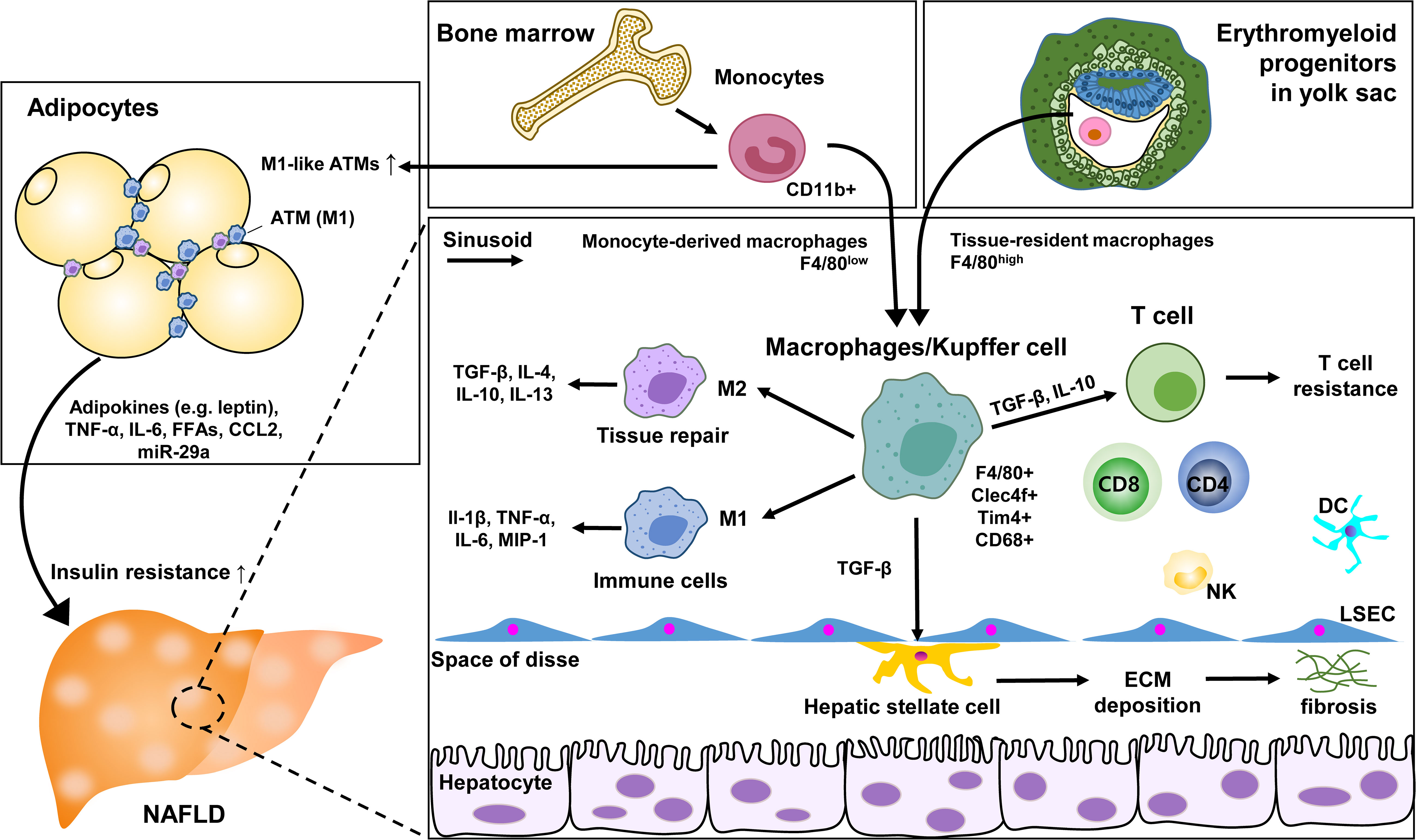 Frontiers Major Roles Of Kupffer Cells And Macrophages In Nafld