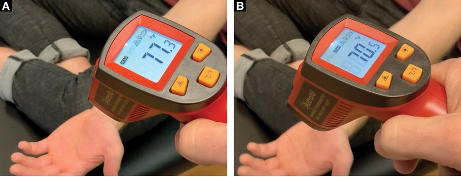 Frontiers Clinical Management Of Finger Joint Capsulitis Synovitis In