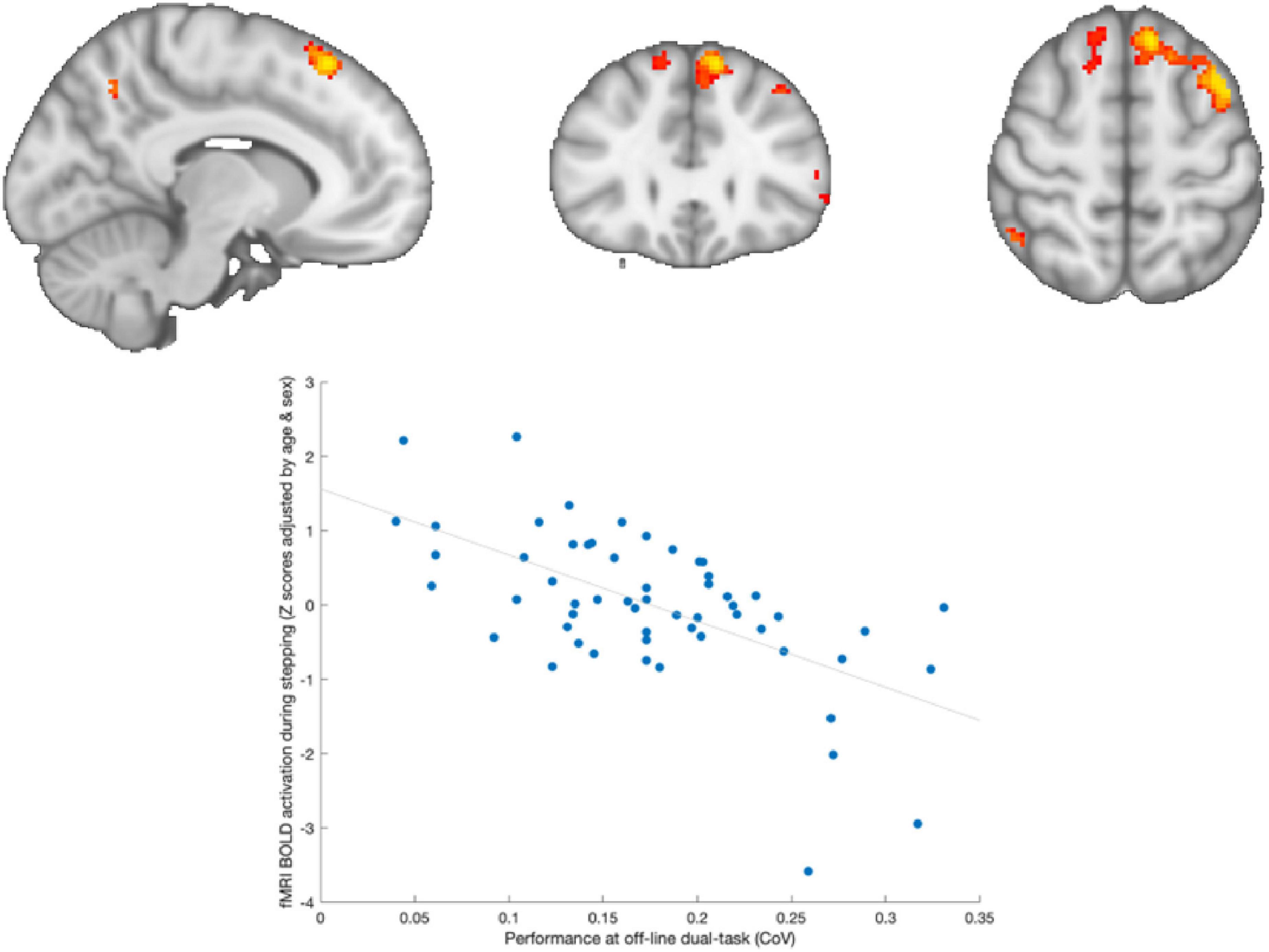 Frontiers | Motor learning in developmental coordination disorder: behavioral and neuroimaging study