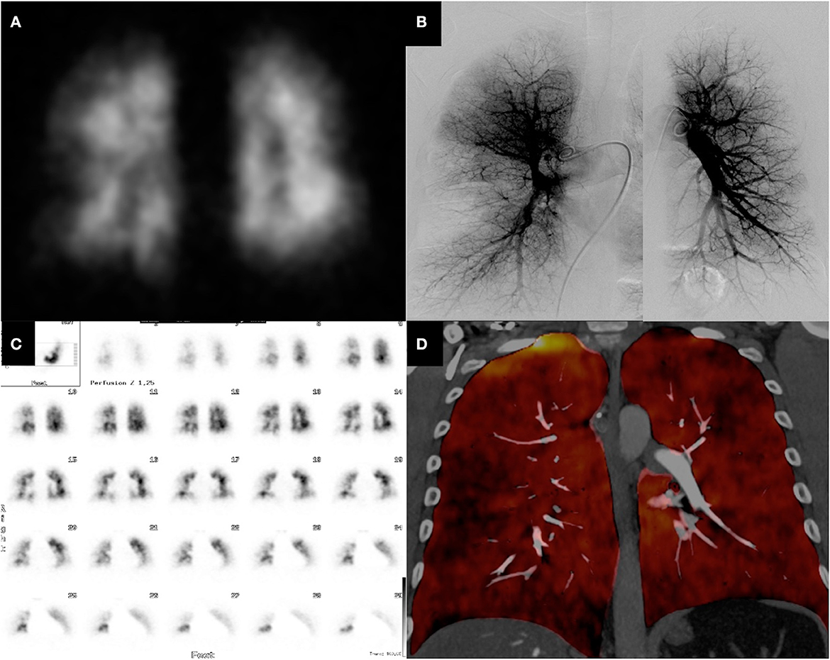 Frontiers Evaluation Of Diagnostic Accuracy Of Dual Energy Computed