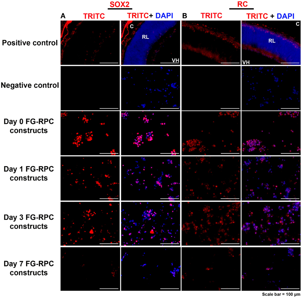 Frontiers Autologous Fibrin Glue As An Encapsulating Scaffold For