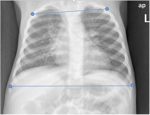 Frontiers | Non-ionizing measurement and quantification of bell-shaped ...