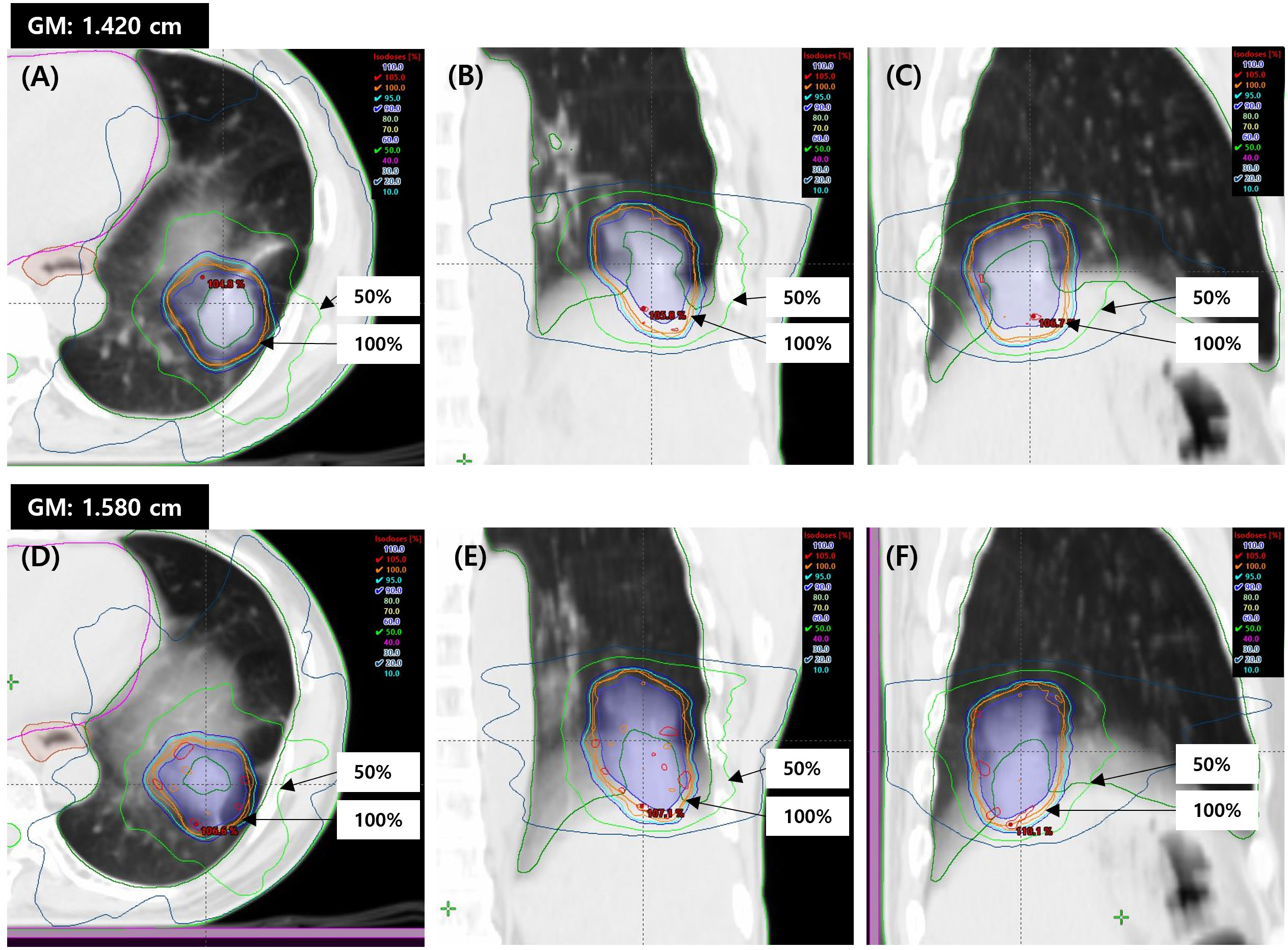 Frontiers Feasibility Of Fast Four Dimensional Computed Tomography