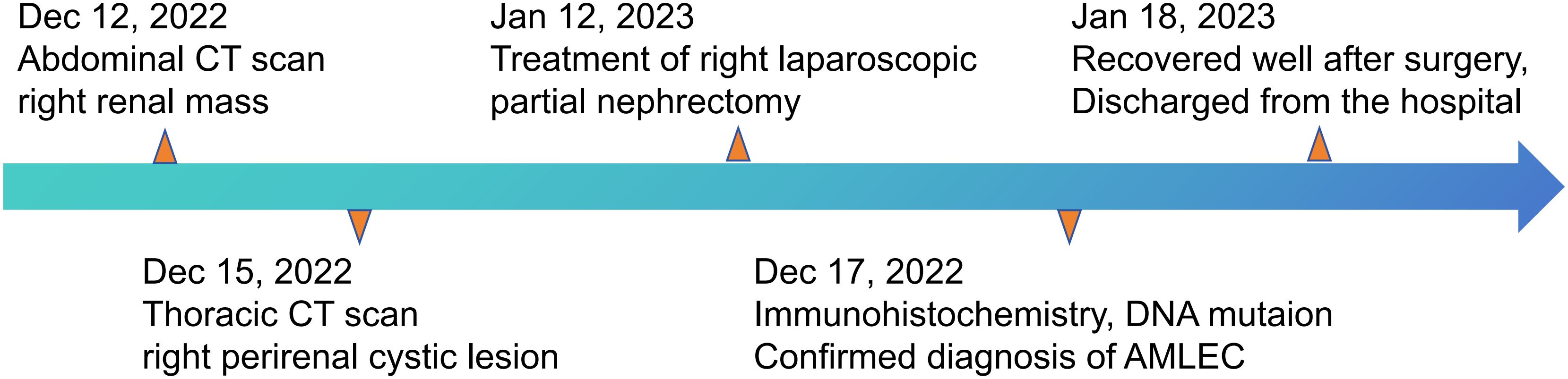 Frontiers Tsc2 Nonsense Mutation In Angiomyolipoma With Epithelial
