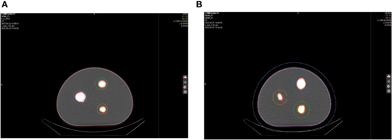 Frontiers | A single-institution experience with 177Lu RPT workflow improvements and qualifying ...