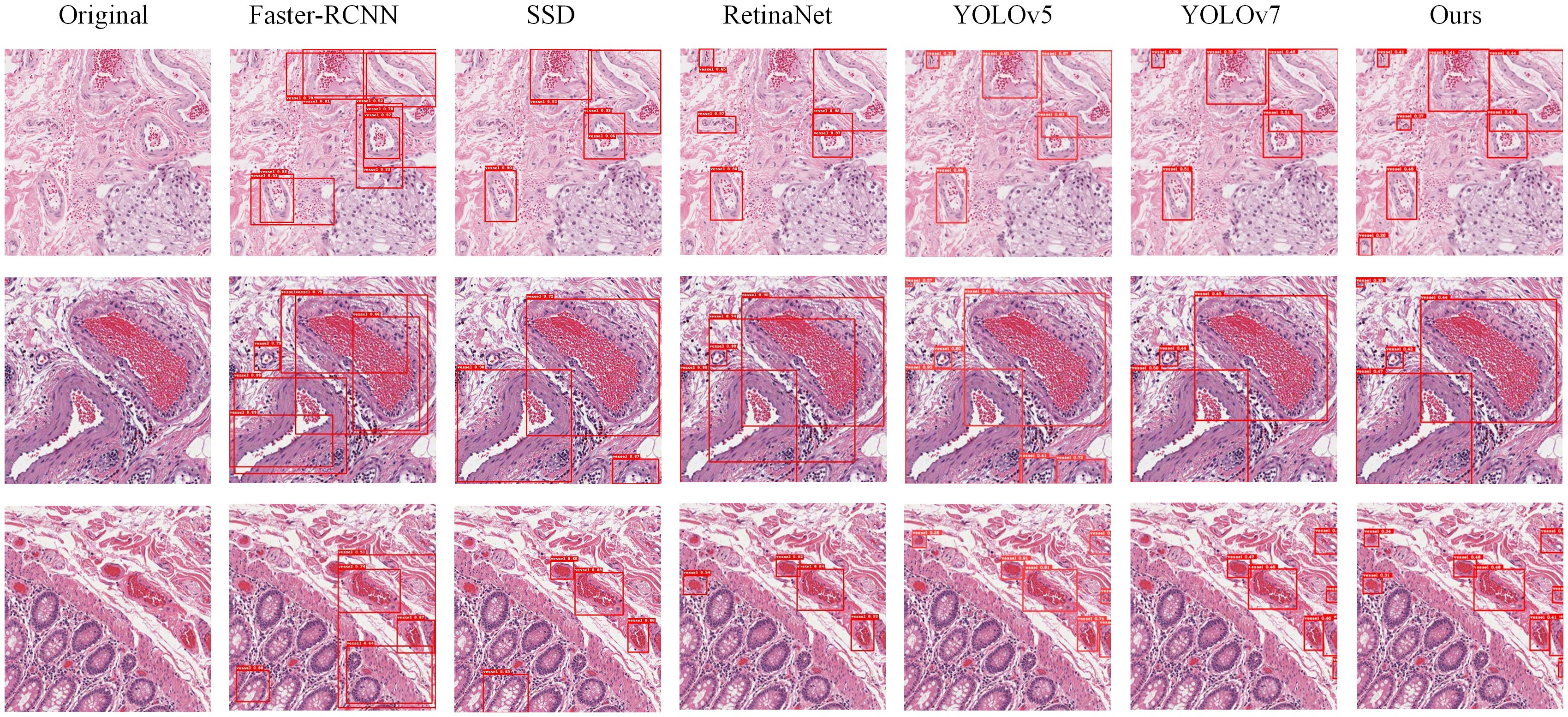 Frontiers | PI-YOLO: dynamic sparse attention and lightweight ...