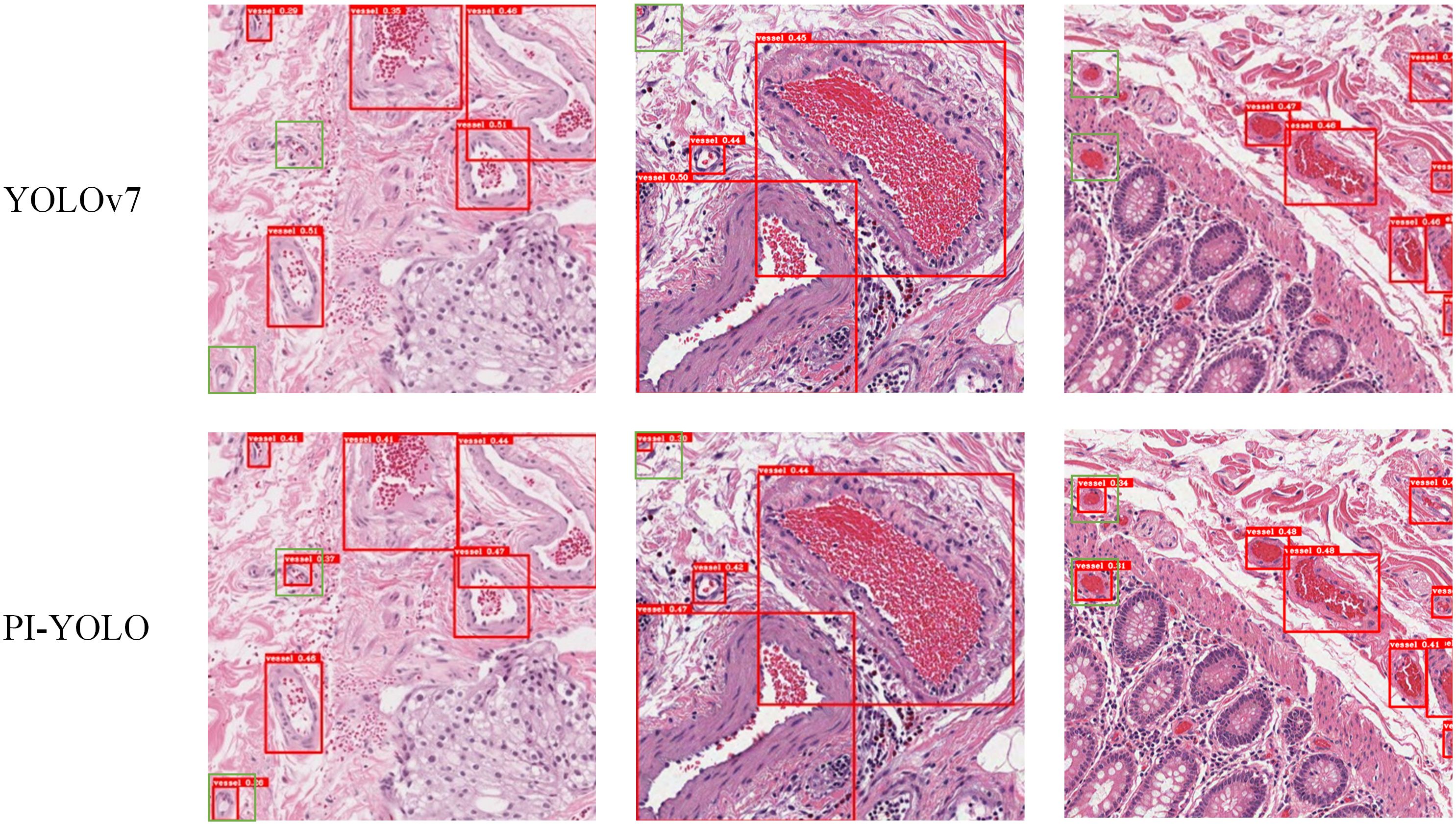 Frontiers | PI-YOLO: dynamic sparse attention and lightweight ...