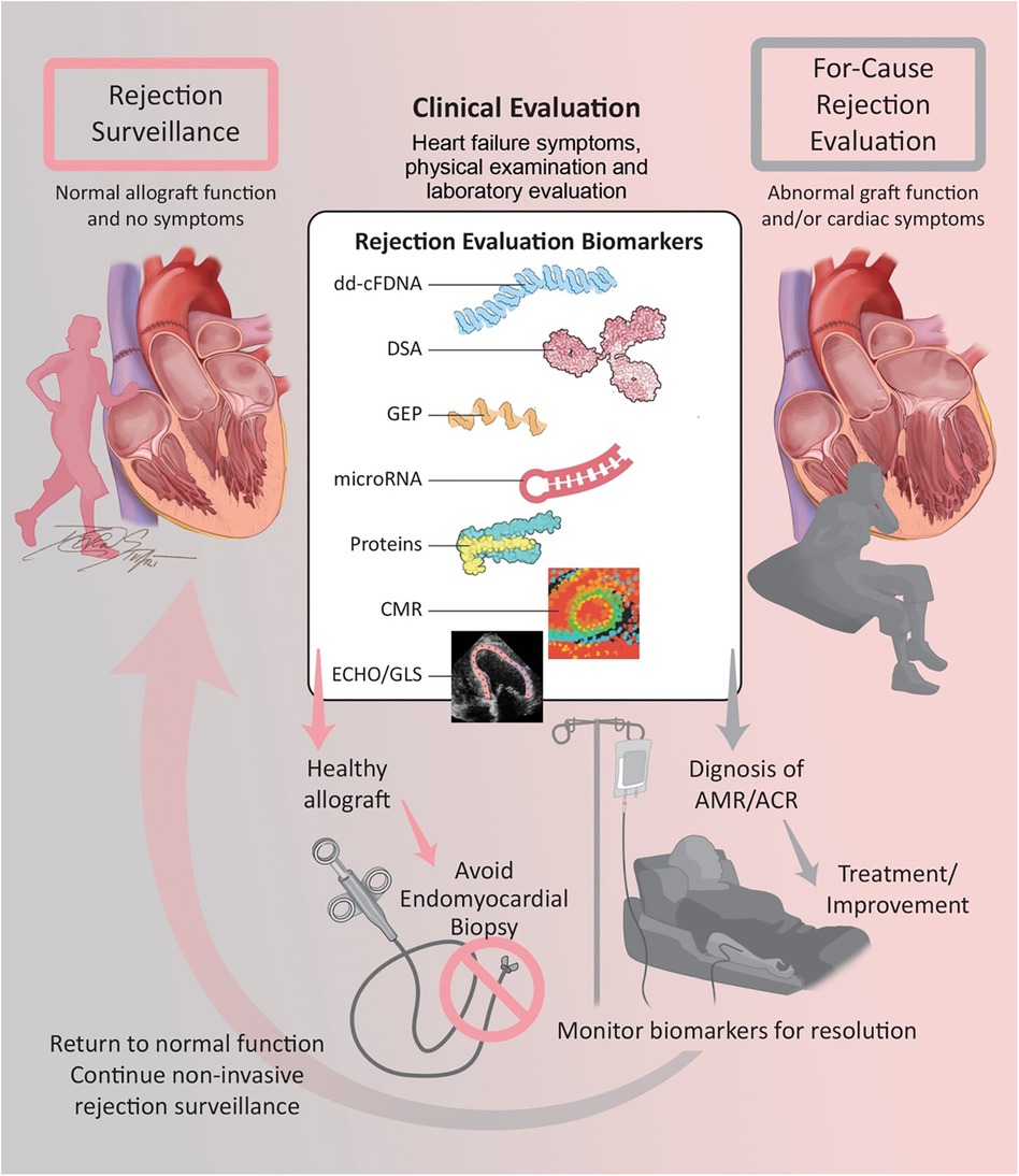 Frontiers | A gentler approach to monitor for heart transplant rejection
