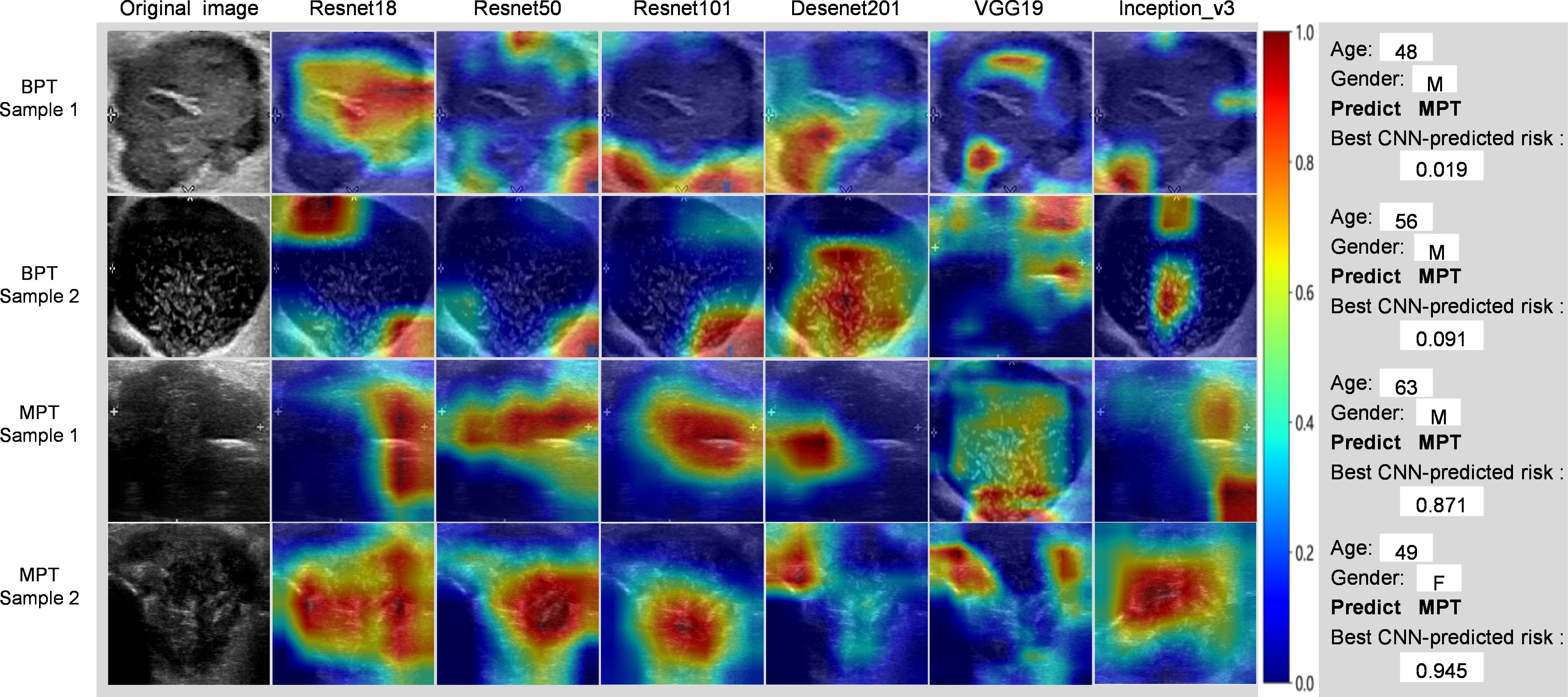 Frontiers Deep Learning Assisted Diagnosis Of Benign And Malignant
