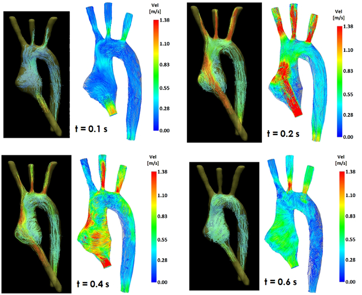 Frontiers Using 4d Cardiovascular Magnetic Resonance Imaging To