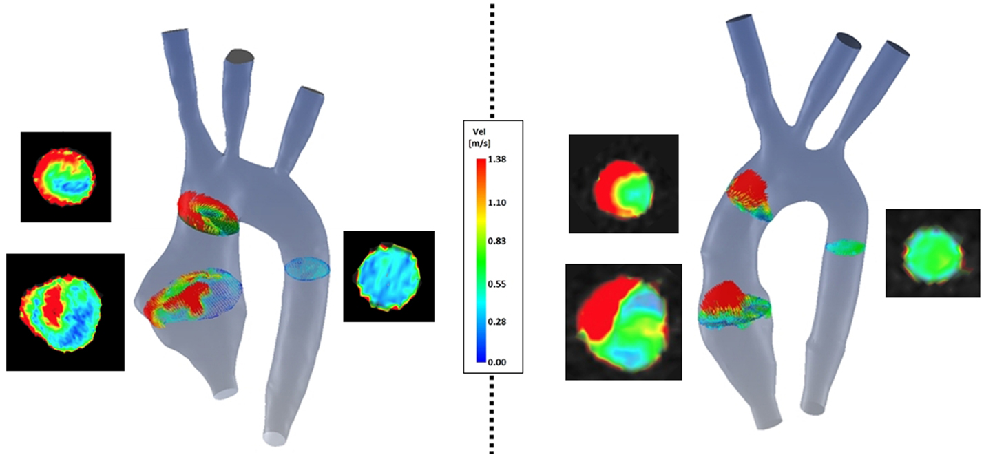 Frontiers Using 4d Cardiovascular Magnetic Resonance Imaging To