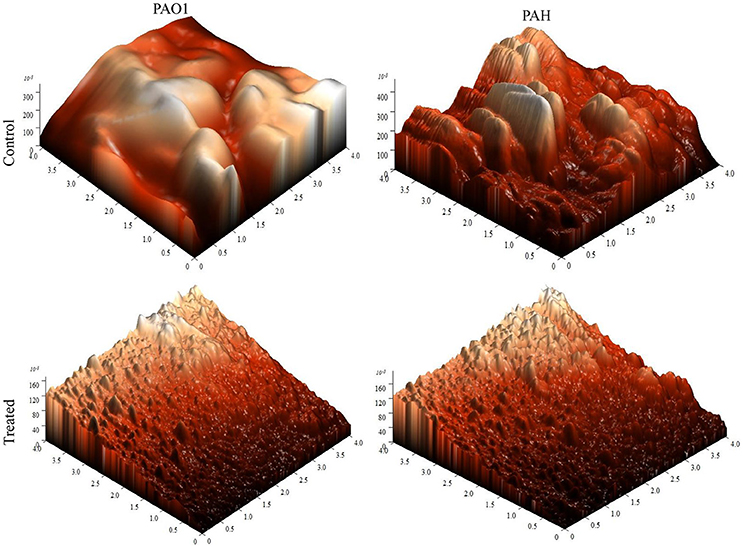 Frontiers | Anti-quorum Sensing and Anti-biofilm Activity of Delftia ...