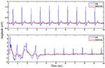 Frontiers | SQI Quality Evaluation Mechanism of Single-Lead ECG Signal ...