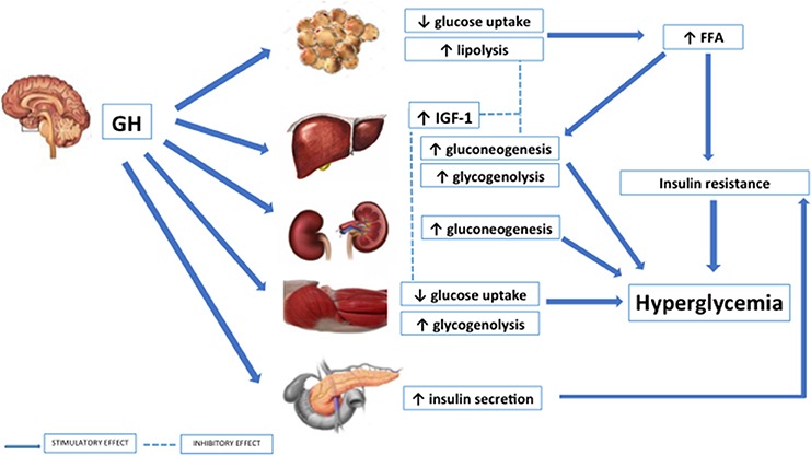 Frontiers Diabetes Secondary To Acromegaly Physiopathology Clinical