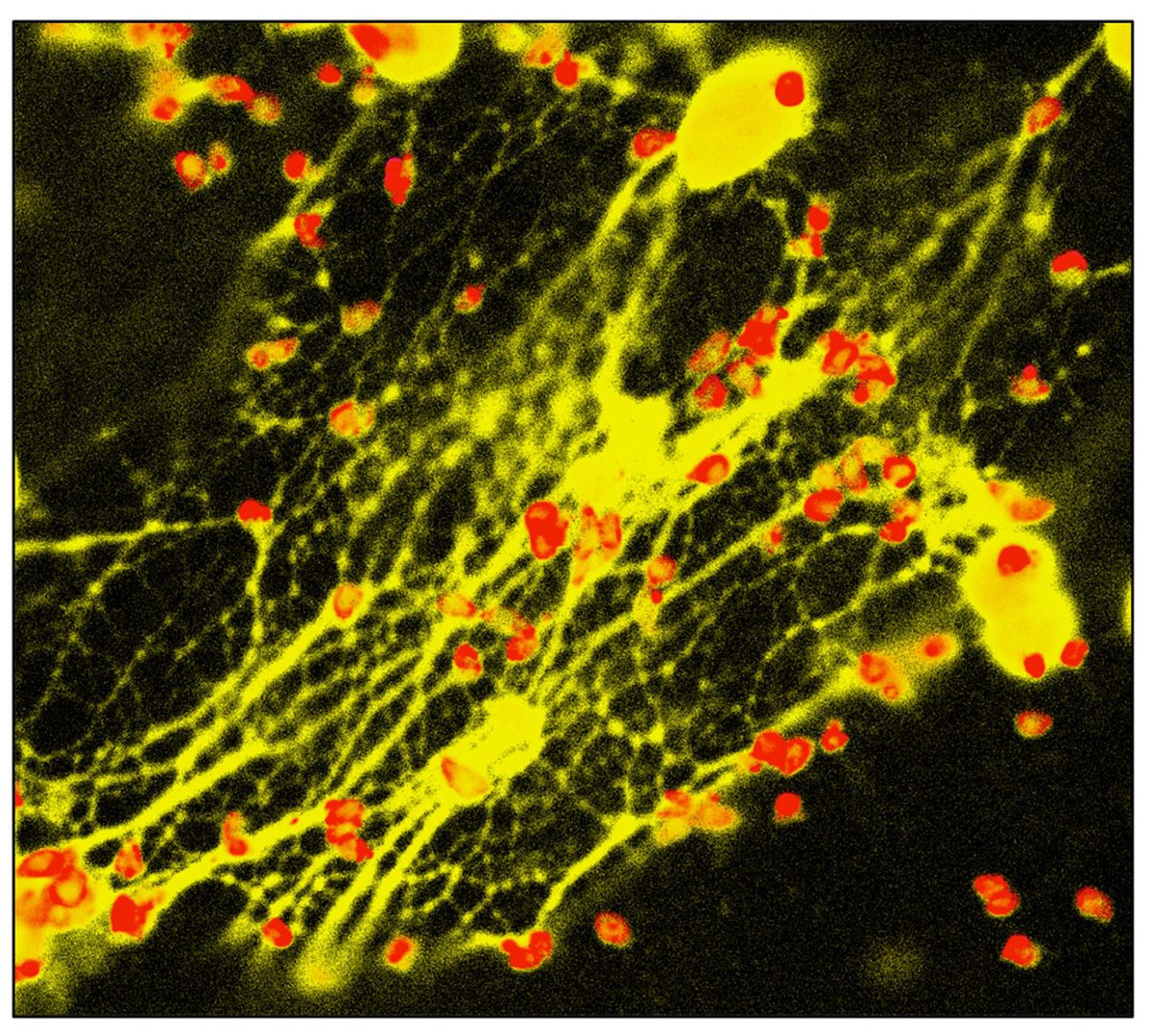 Frontiers Neutrophils Cast Extracellular Traps In Response To