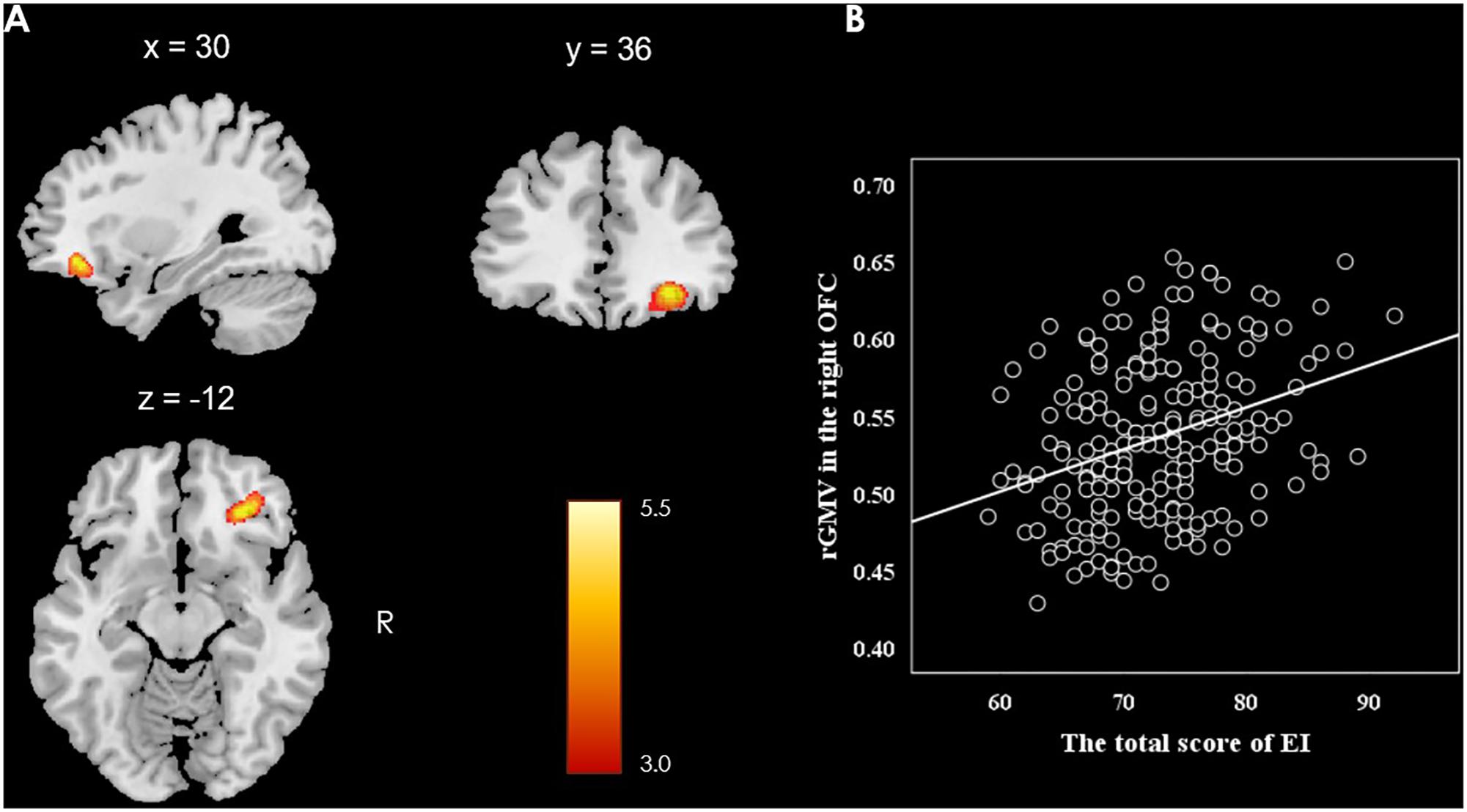 Emotional Intelligence Brain Structure
