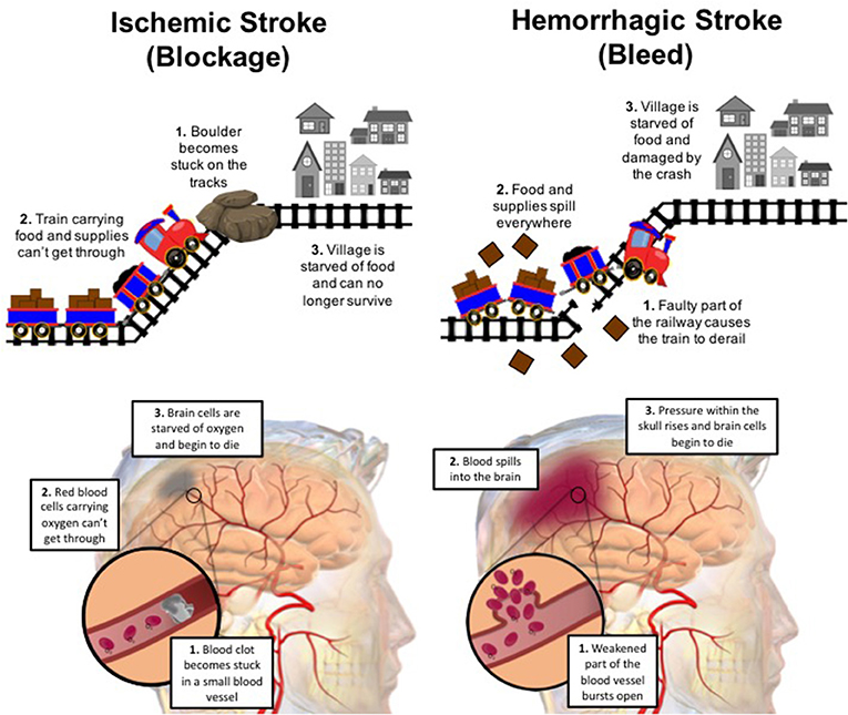 Recovery After A Stroke Five Tips For Rehabilitation Frontiers For