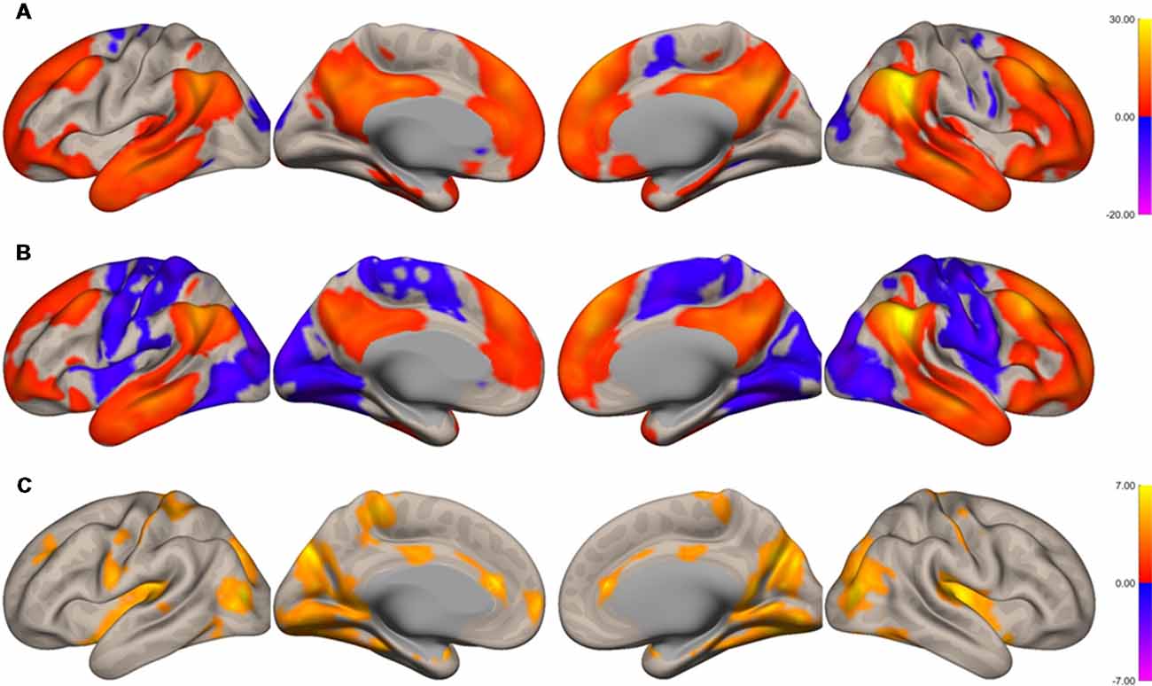 Frontiers | Increased Functional Connectivity of the Angular Gyrus ...
