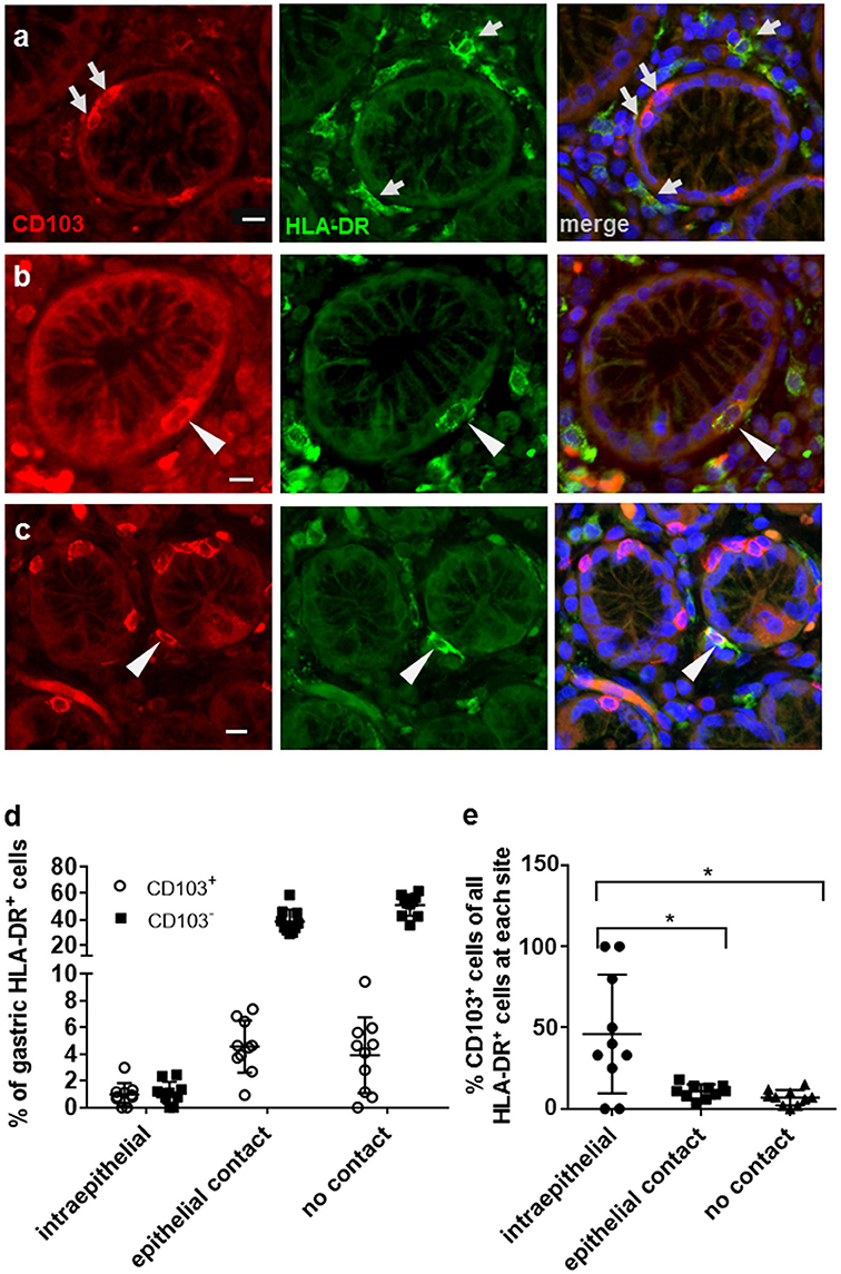 Frontiers Cd103 αe Integrin Undergoes Endosomal Trafficking In