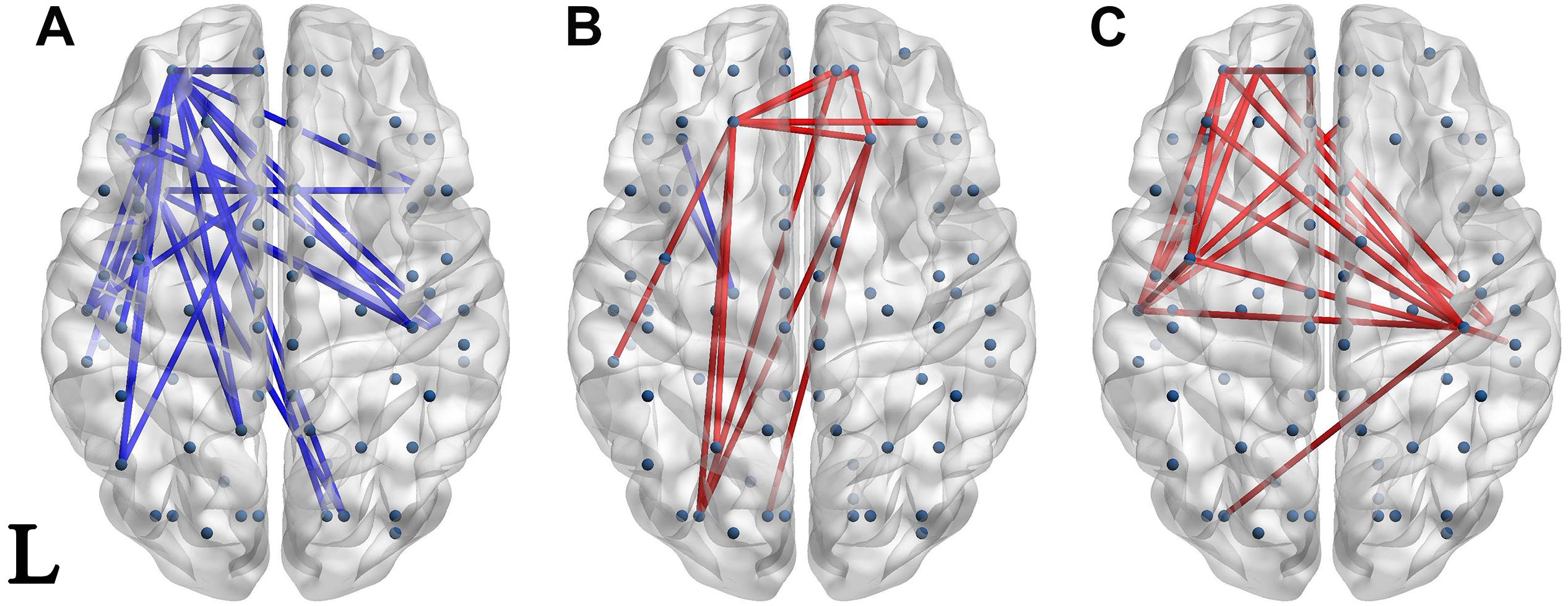 Frontiers Eeg Based Brain Functional Connectivity In First Episode
