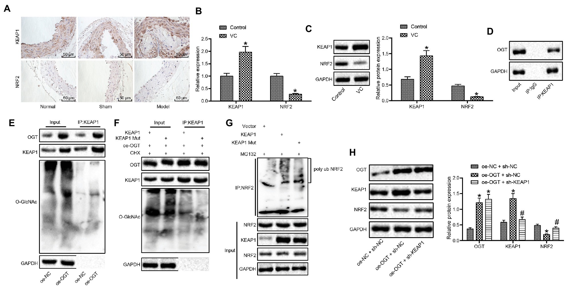Frontiers | OGT-Mediated KEAP1 Glycosylation Accelerates NRF2 ...