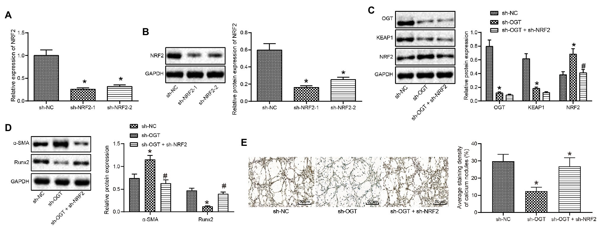 Frontiers | OGT-Mediated KEAP1 Glycosylation Accelerates NRF2 ...