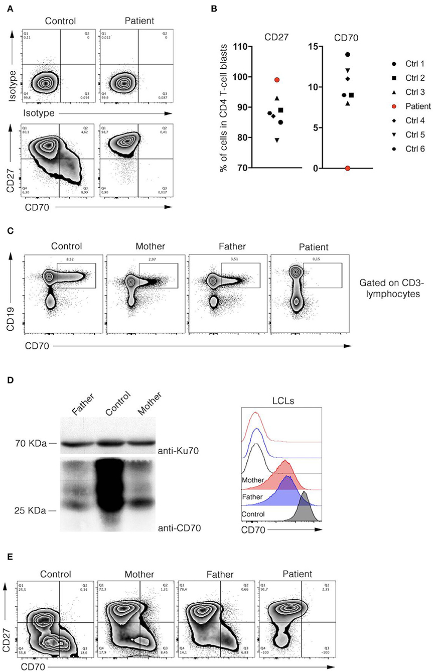 Frontiers Cd70 Deficiency Associated With Chronic Epstein Barr Virus