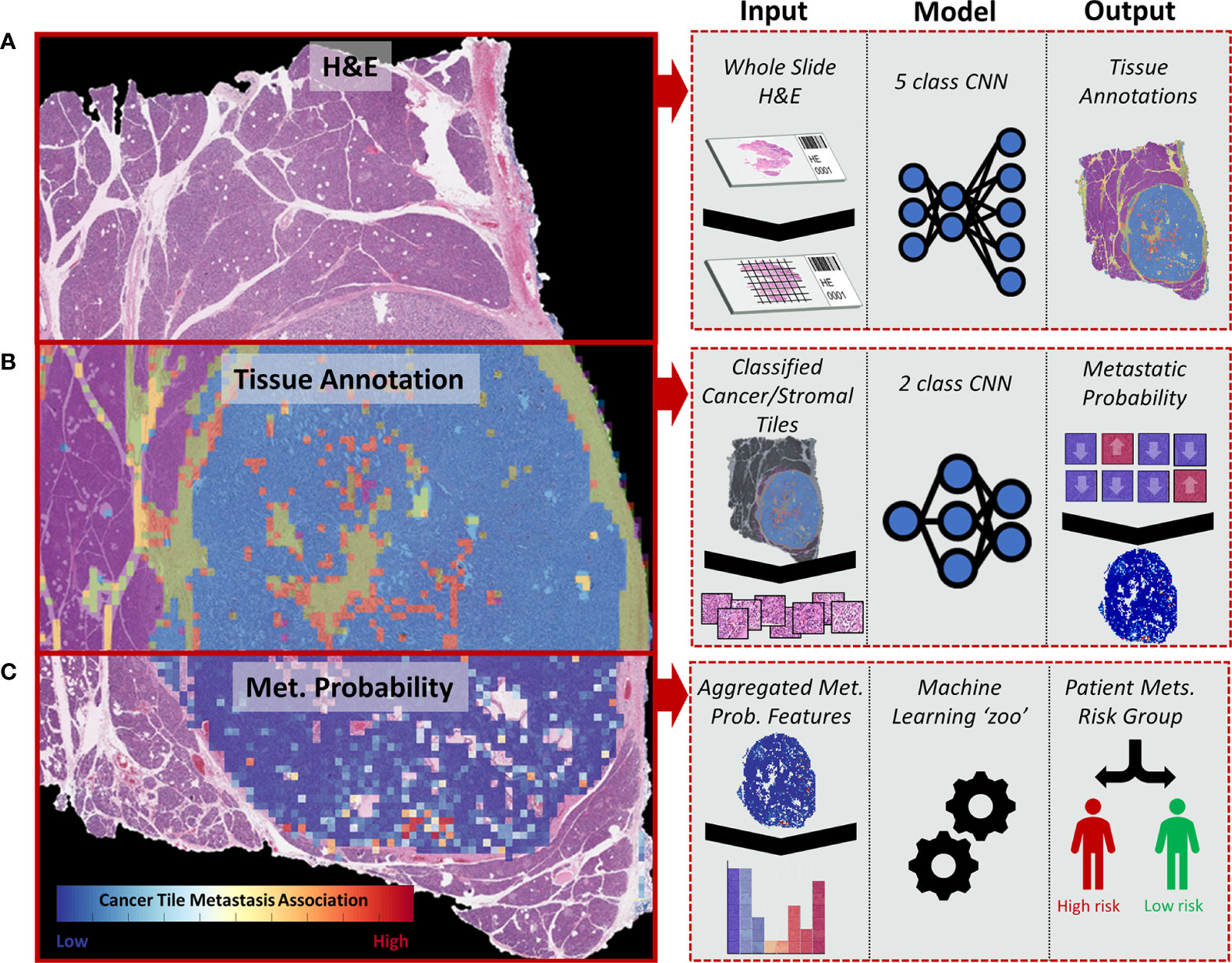 Frontiers Predicting Metastasis Risk In Pancreatic Neuroendocrine