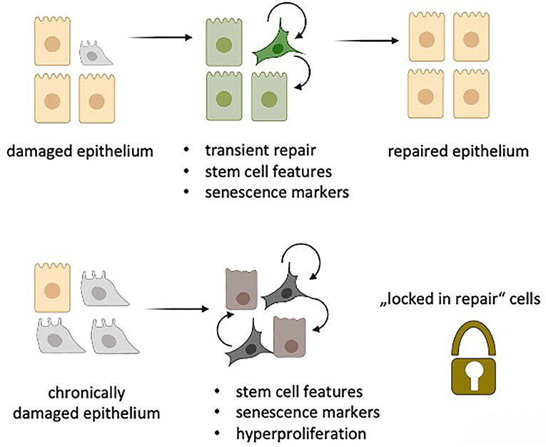 Frontiers Senescent Cells In Ipf Locked In Repair