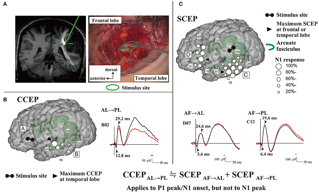 Frontiers Intraoperative Brain Mapping By Cortico Cortical Evoked