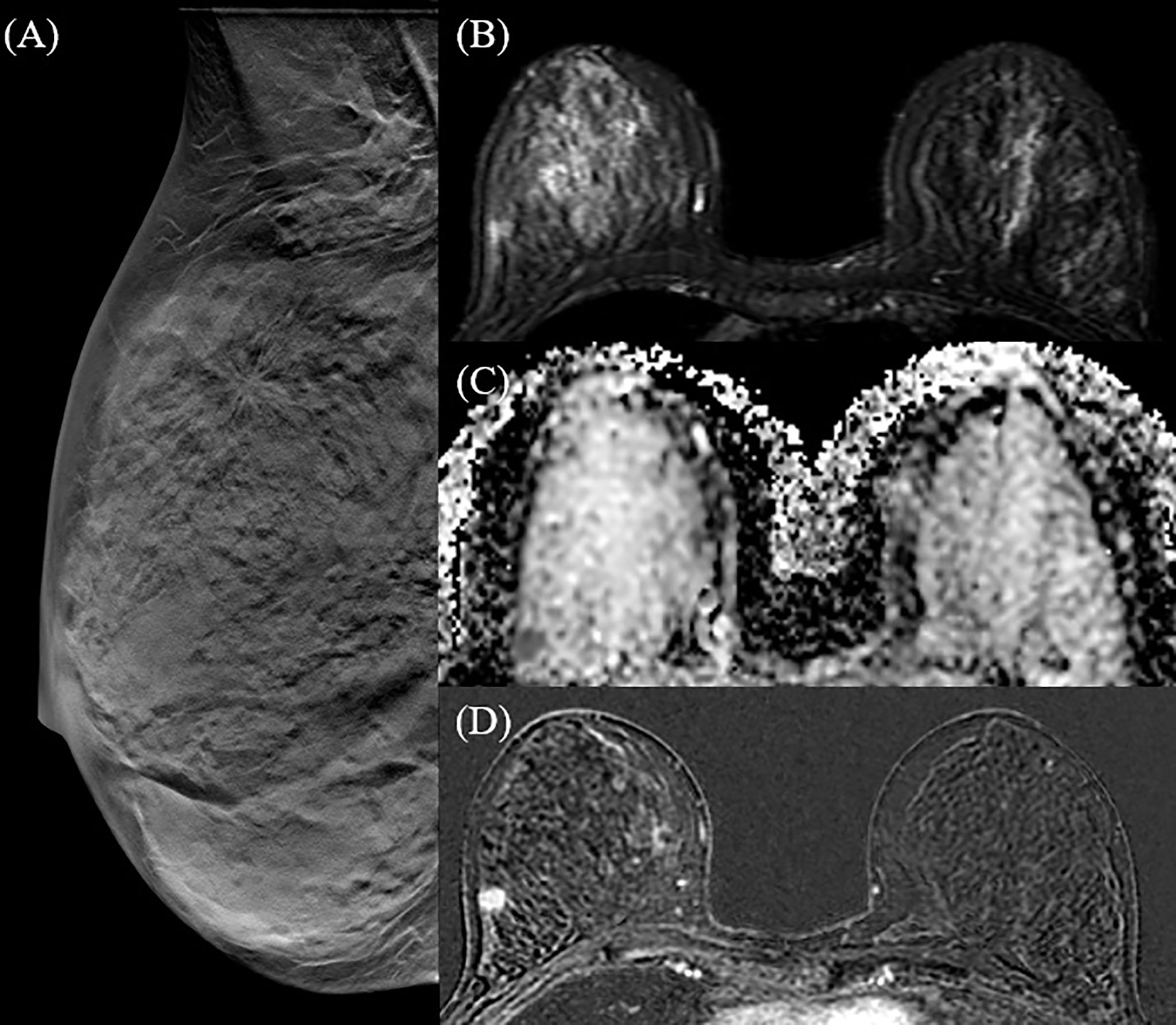 Frontiers Preoperative Staging In Breast Cancer Intraindividual