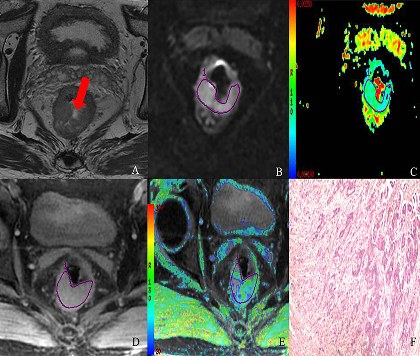 Frontiers Quantitative T2 Weighted Imaging And Reduced Field Of View