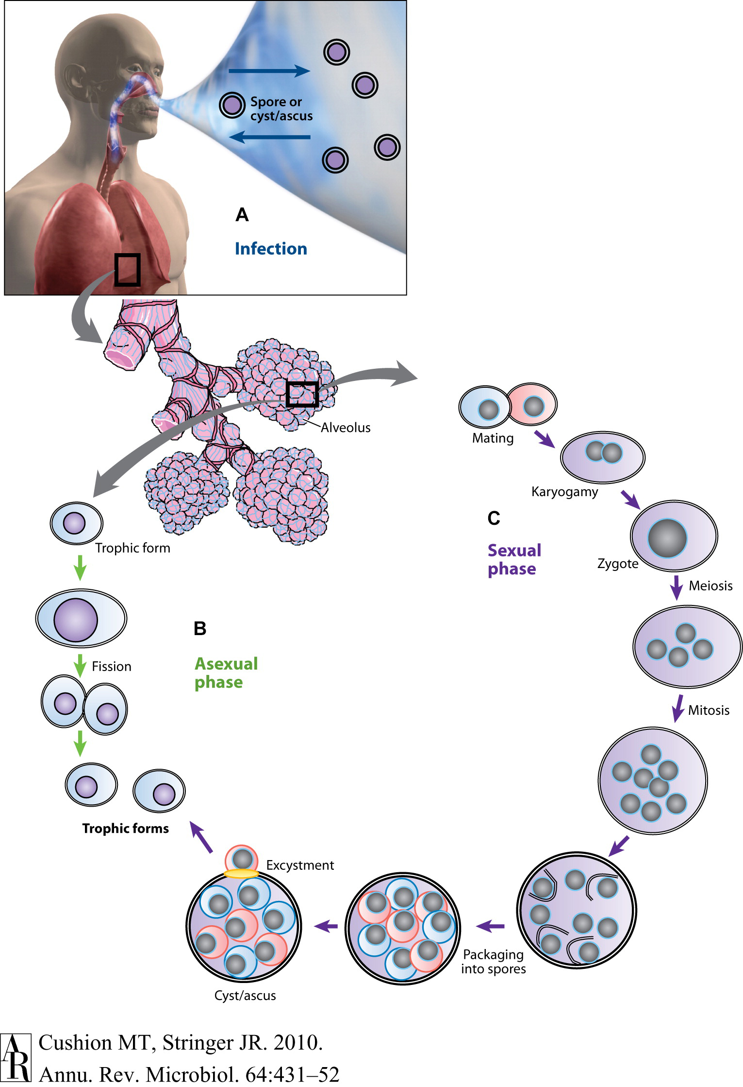 Pneumocystis Pneumonia Fungal Diseases CDC 60 OFF