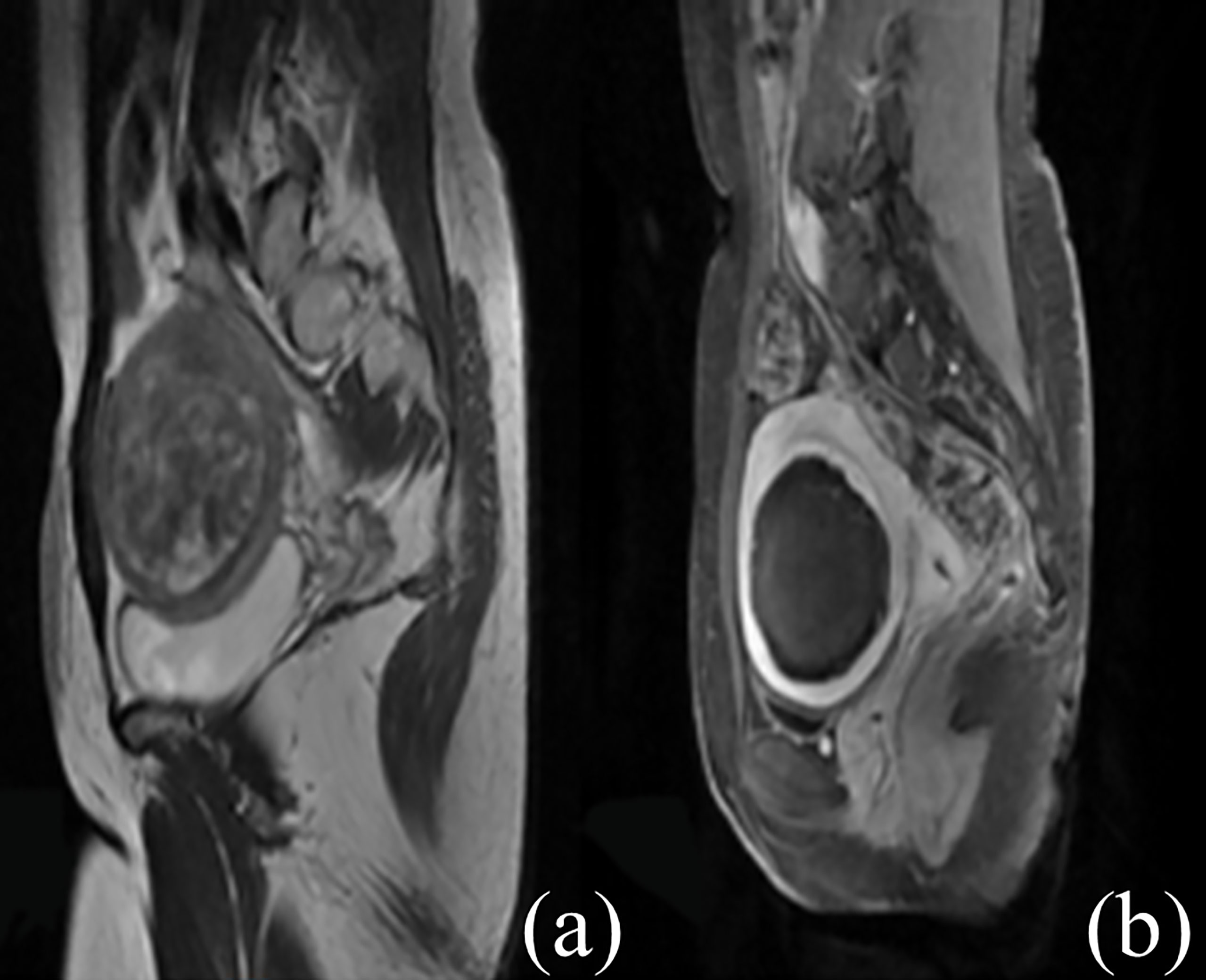 Frontiers Comparison Of Dose And Effectiveness Of A Single Session
