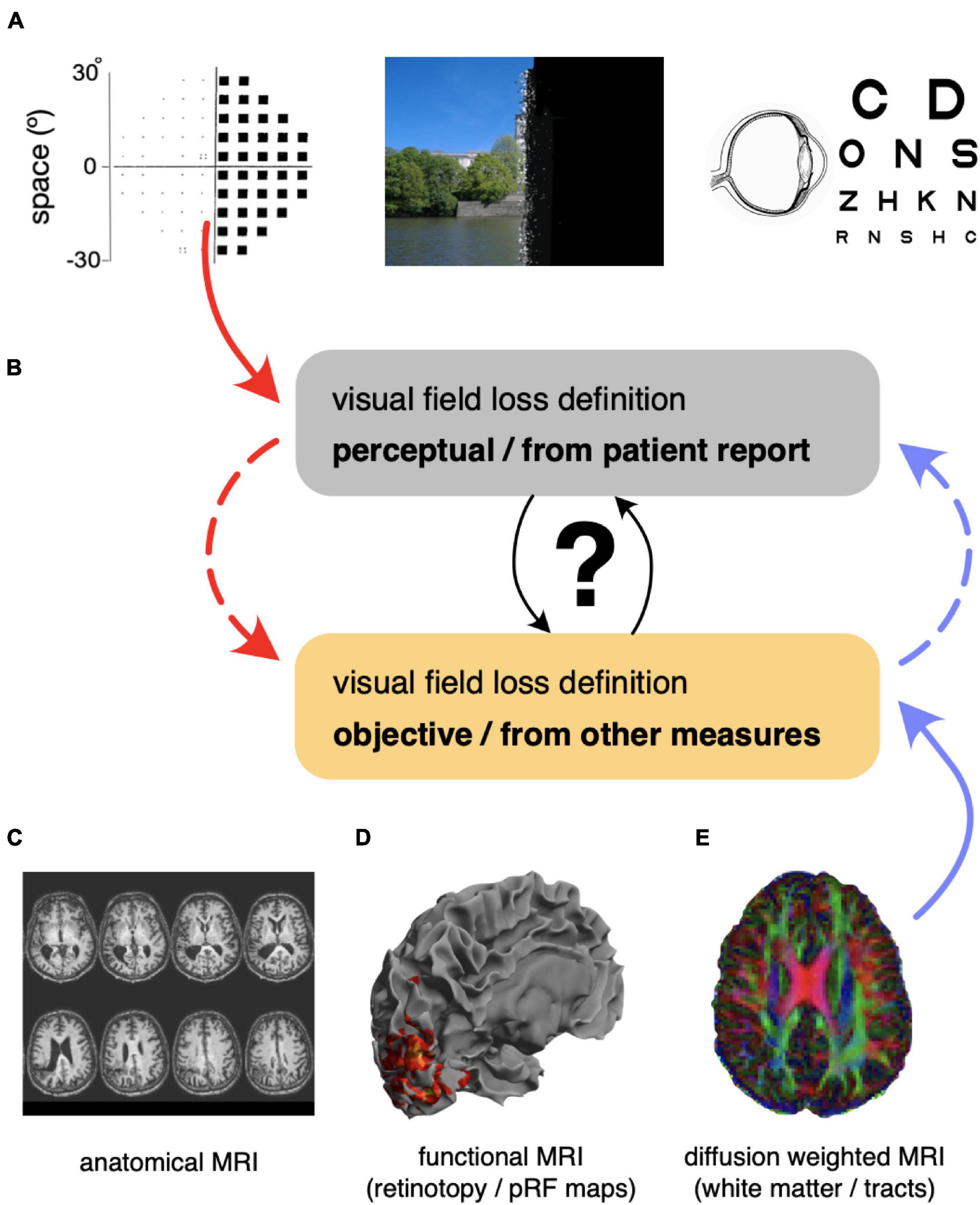 Frontiers Linking Multi Modal MRI To Clinical Measures Of Visual