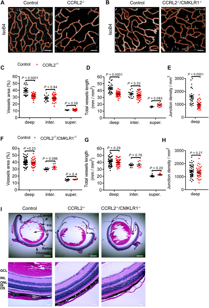 Frontiers Ccrl2 Modulates Physiological And Pathological Angiogenesis
