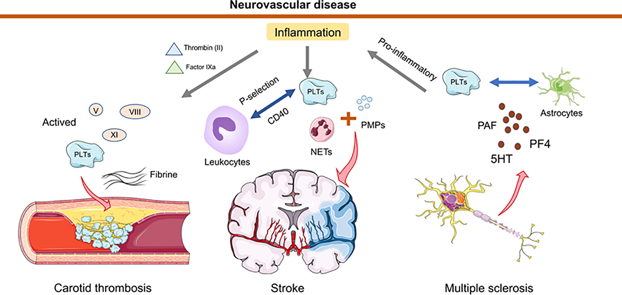 Frontiers Platelets Thromboinflammation And Neurovascular Disease