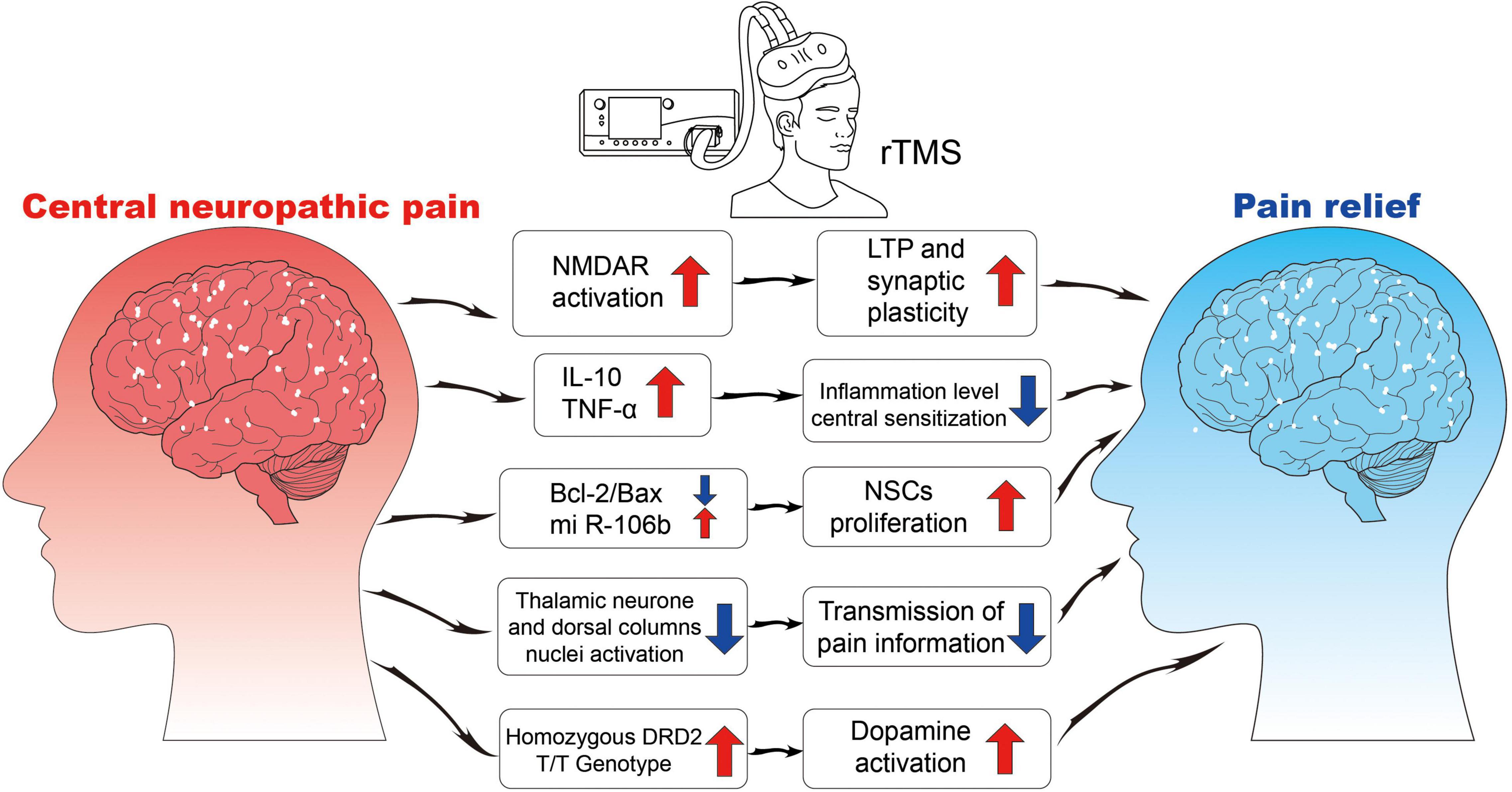 Frontiers Non invasive Brain Stimulation For Central Neuropathic Pain