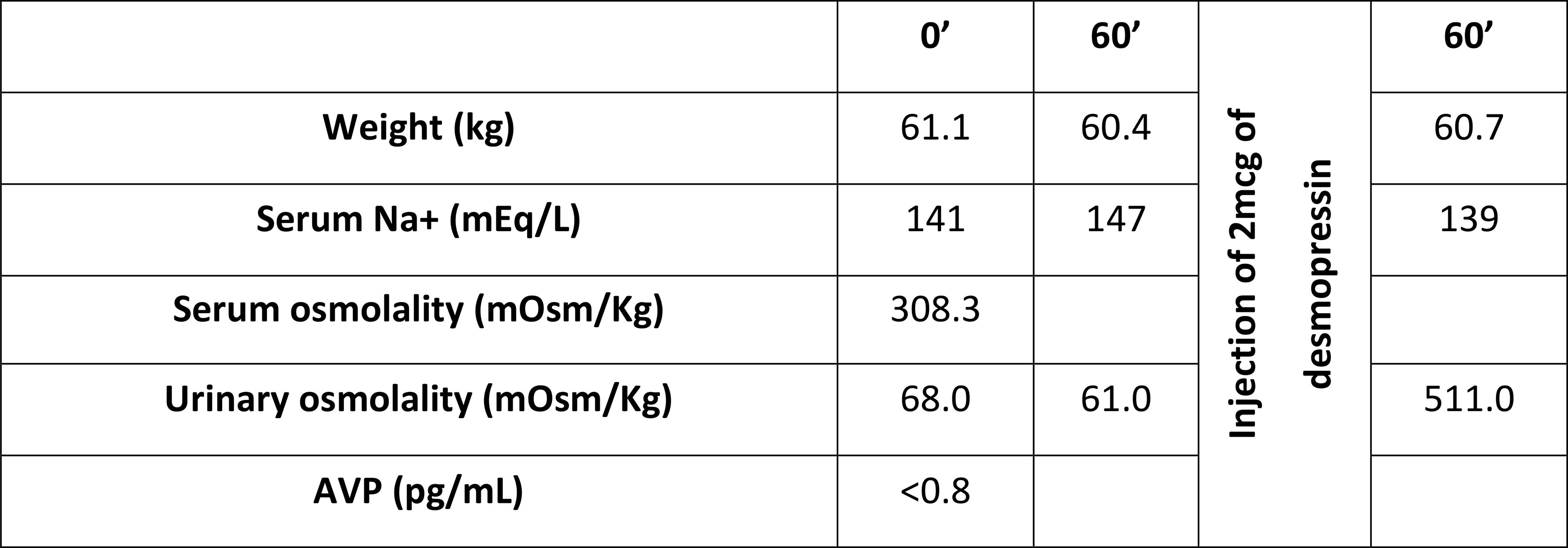 Frontiers Central Diabetes Insipidus Following Immunization With 