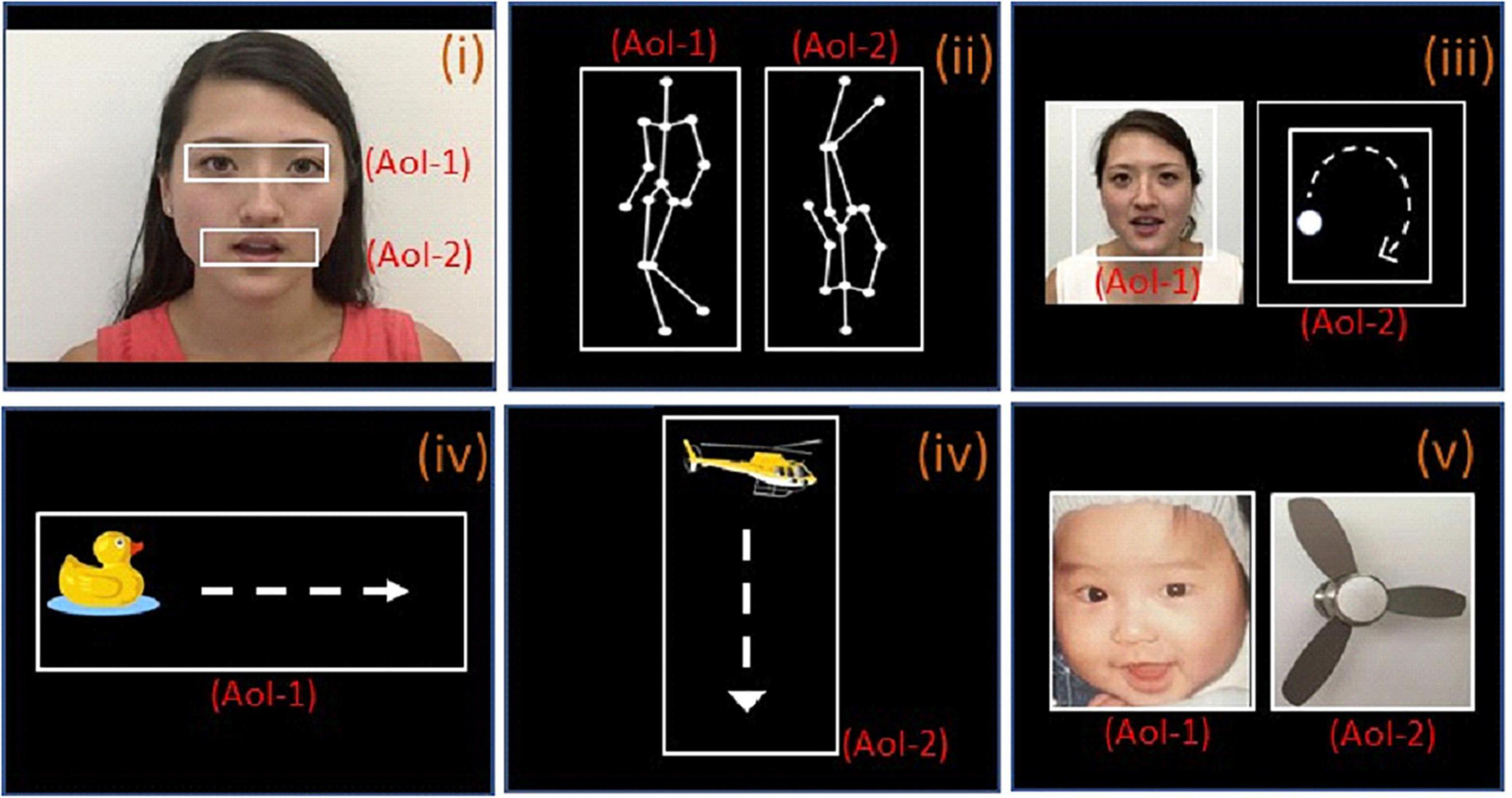 Frontiers Different Eye Tracking Patterns In Autism Spectrum Disorder 